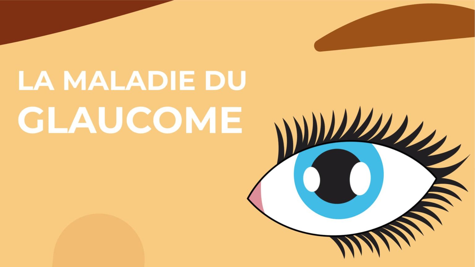 La maladie du glaucome : définition, symptômes, traitement ...